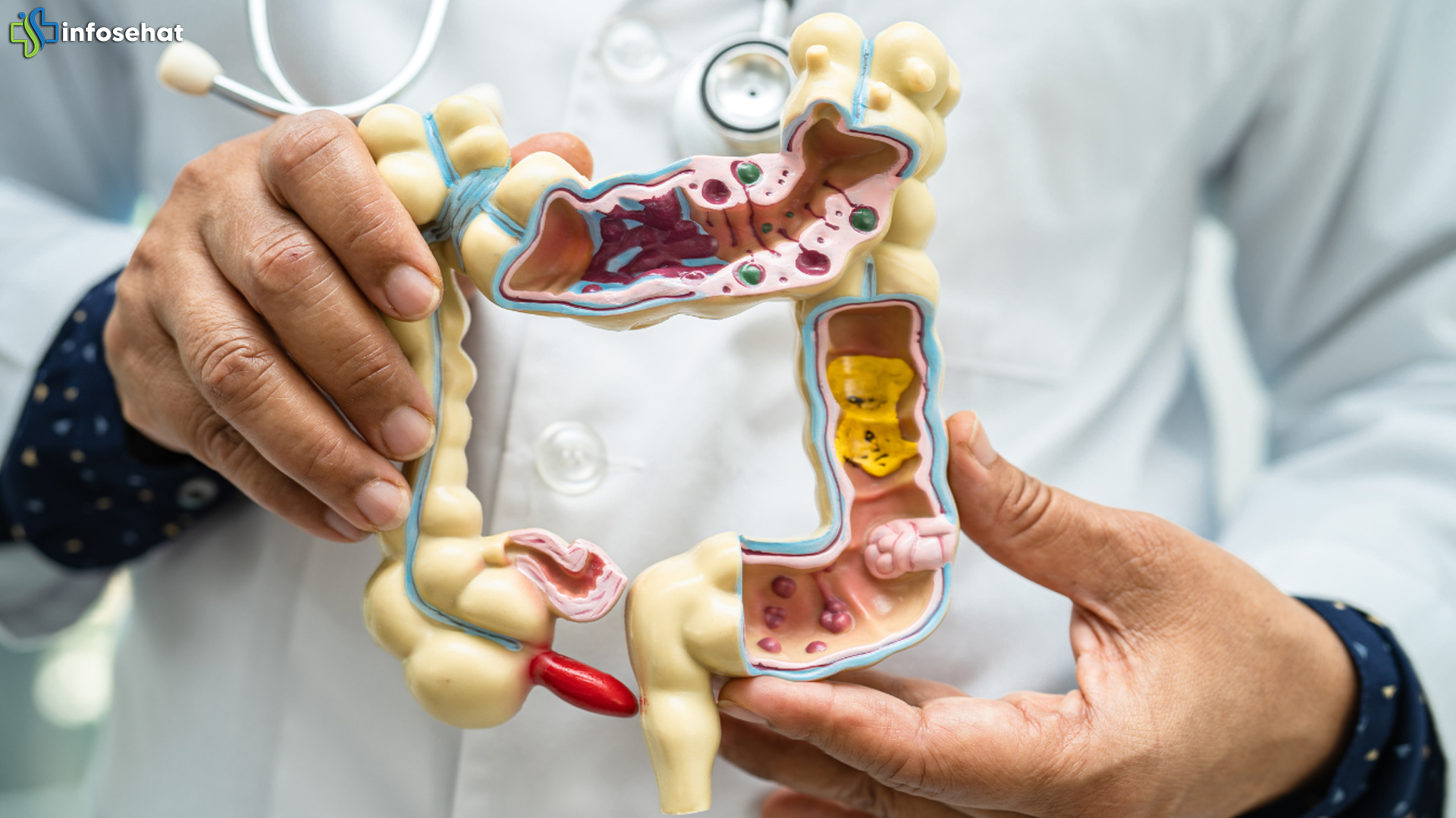 Gejala Radang Usus Buntu 4 Tanda dari Nyeri Perut Sampai Diare